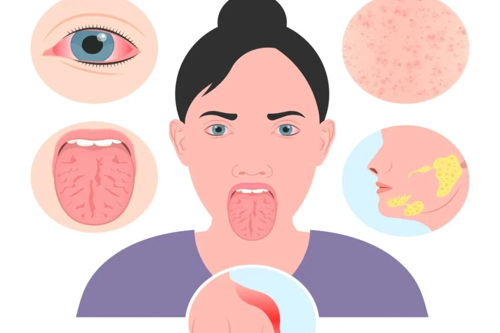 Connective Tissue & Autoimmune Diseases – Acord Clinic